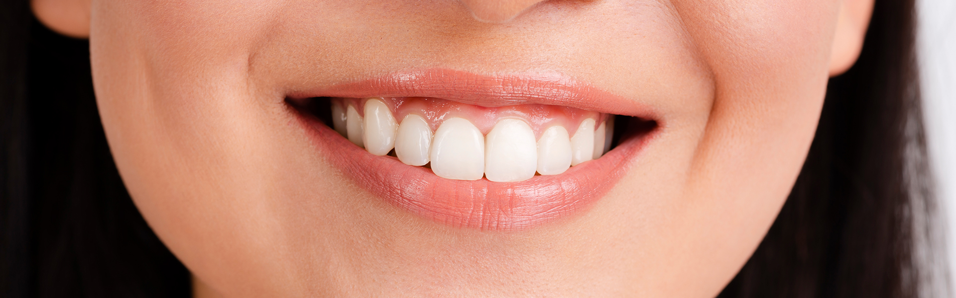 Top Reasons to Choose Professional Teeth Whitening | Blog